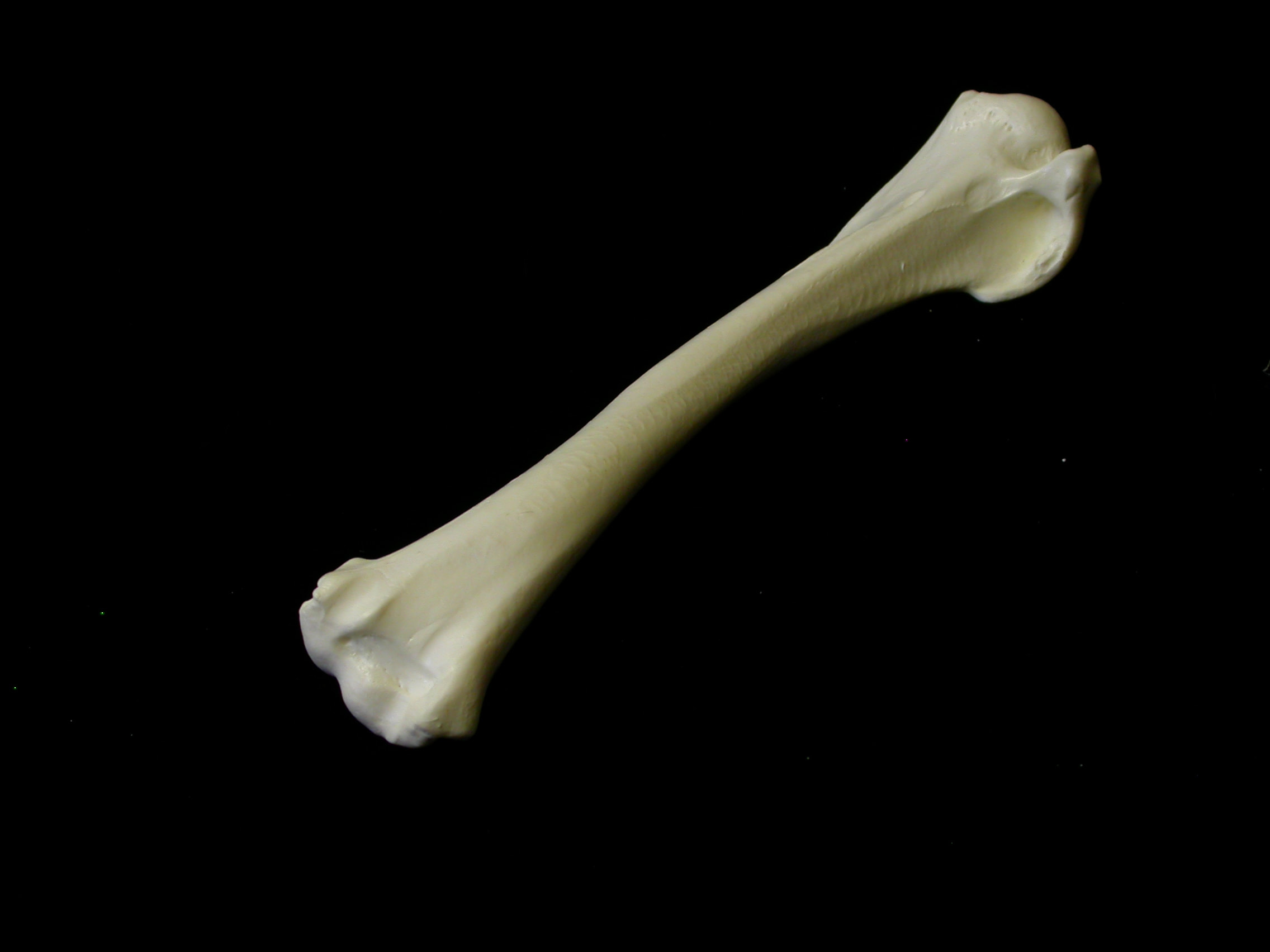 Real Human Femur